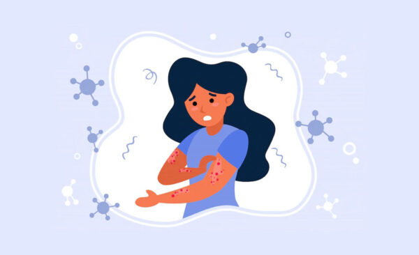Guide to Treating Skin Infection - Types, Cause, & Treatment